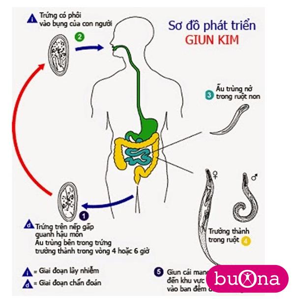 Cách bắt giun kim bằng nước ấm cho bé thế nào? Có hiệu quả không
